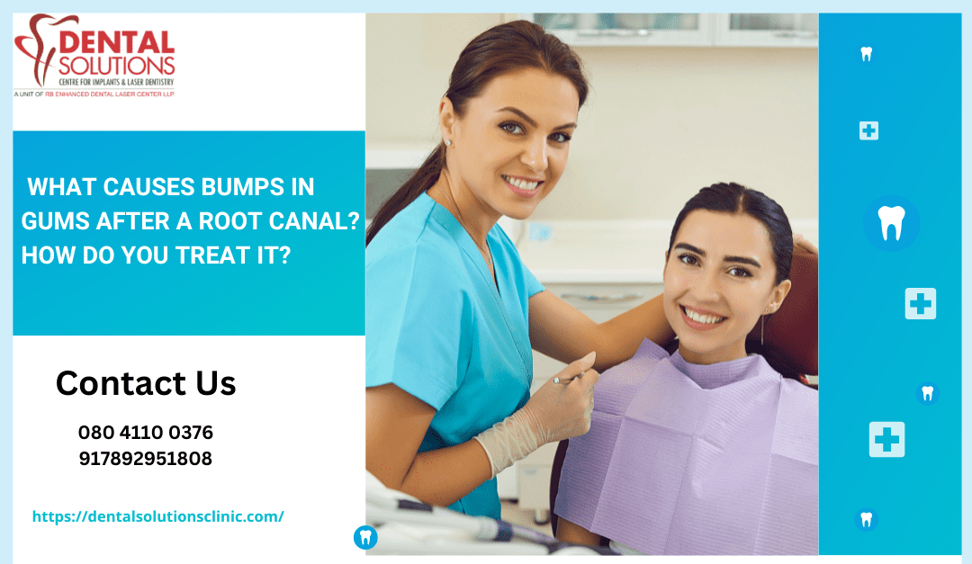 Bumps on Gums After Root Canal | Causes & Treatment
