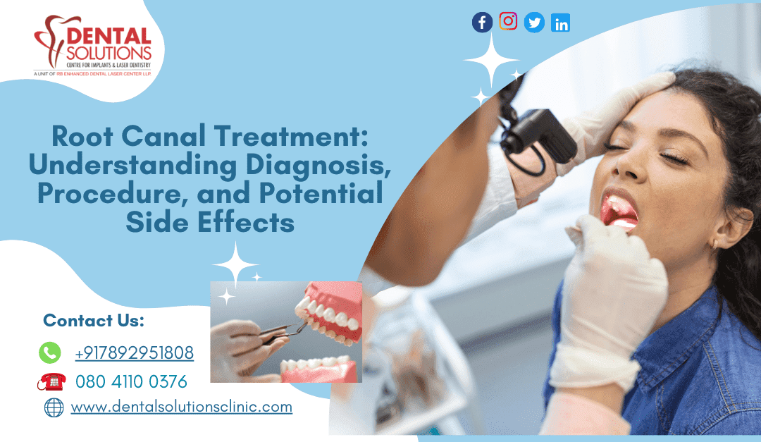 Root Canal Treatment: Understanding Diagnosis, Procedure, and Potential ...