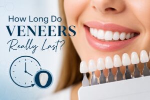 How Long Do Veneers Last? Expert Guide Bangalore
